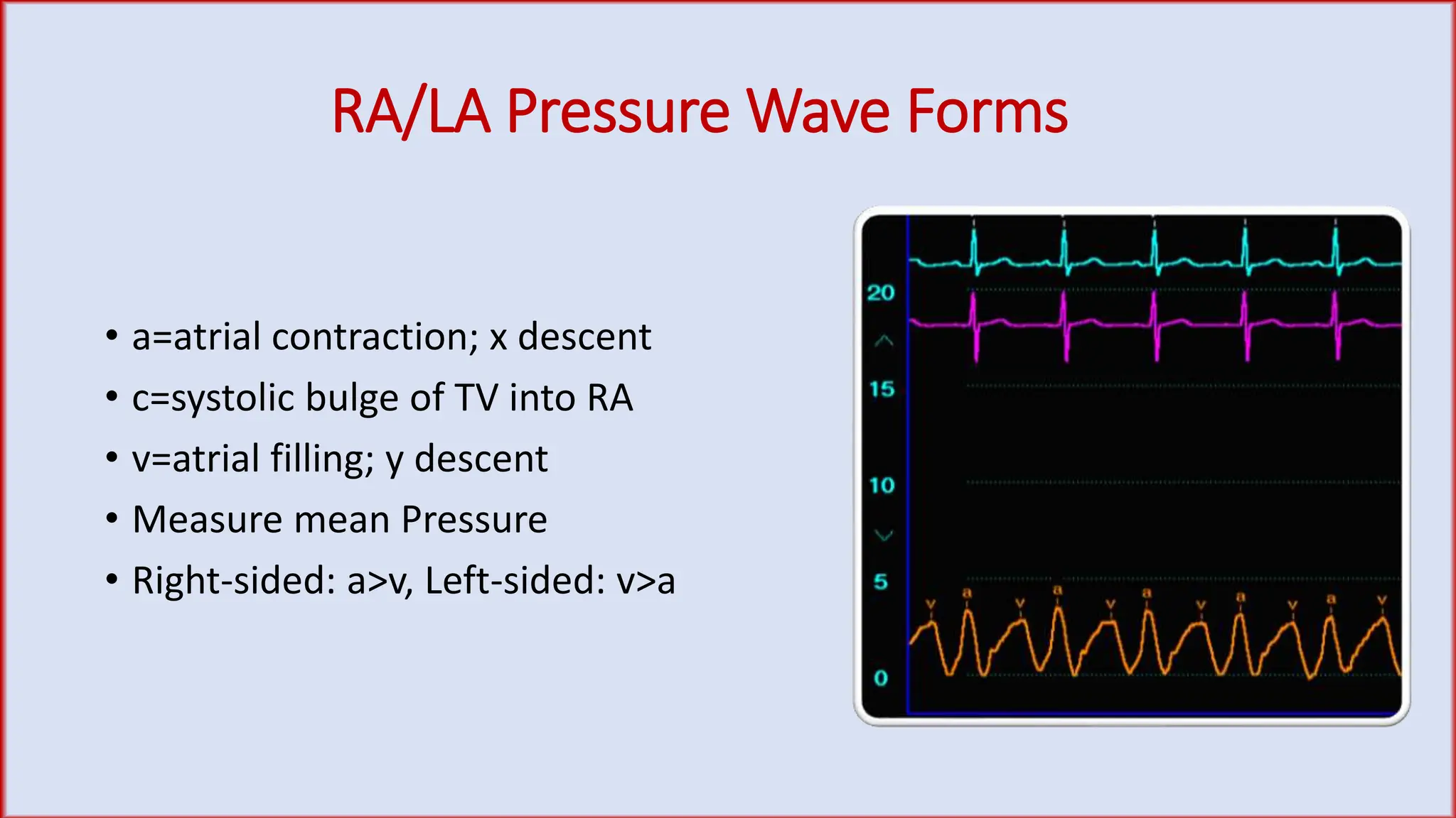 Invasive Hemodynamics: Assessment and interpretation | PDF