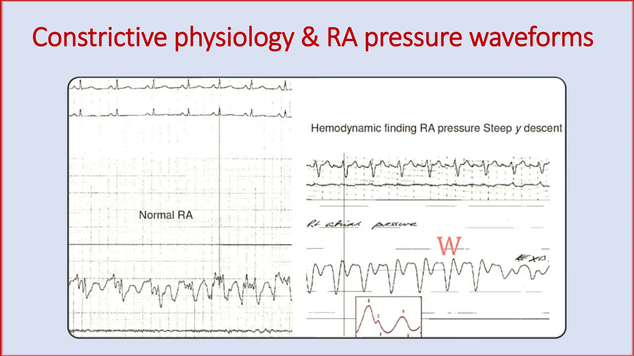 Invasive Hemodynamics: Assessment and interpretation | PDF