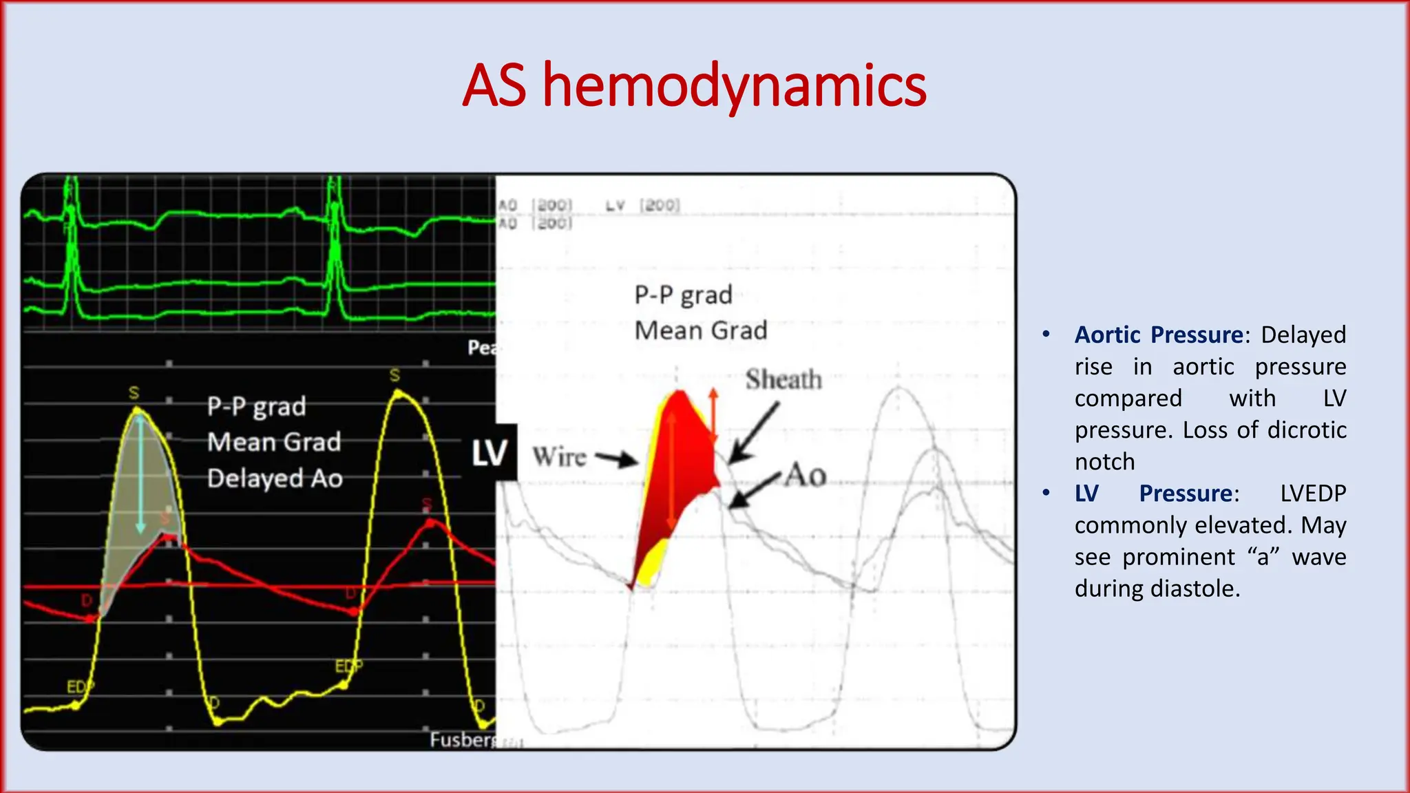 Invasive Hemodynamics: Assessment and interpretation | PDF