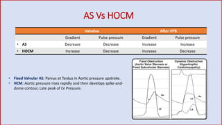 Invasive Hemodynamics: Assessment and interpretation | PDF