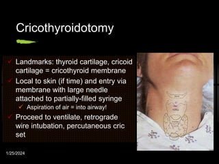 Invasive Management Airway.ppt