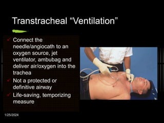 Invasive Management Airway.ppt