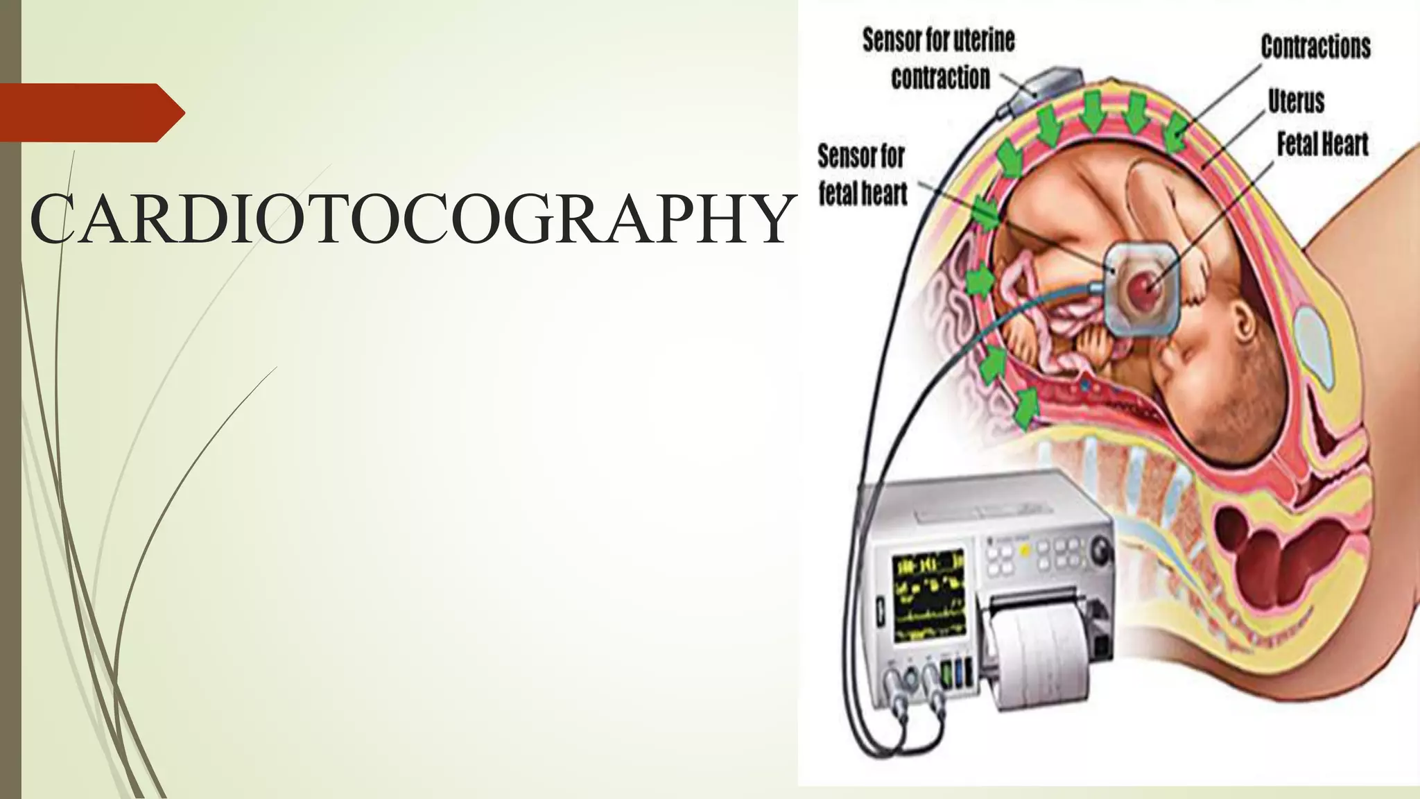 Invasive & non invasive procedure for diagnosis during pregnamncy | PPTX