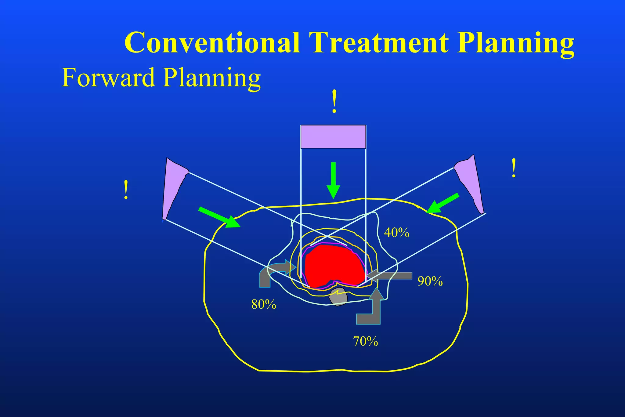 Inverse Planning | PPT