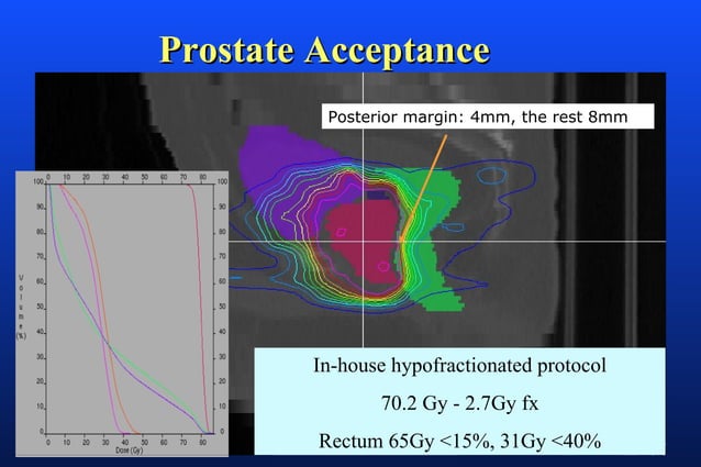 Inverse Planning | PPT