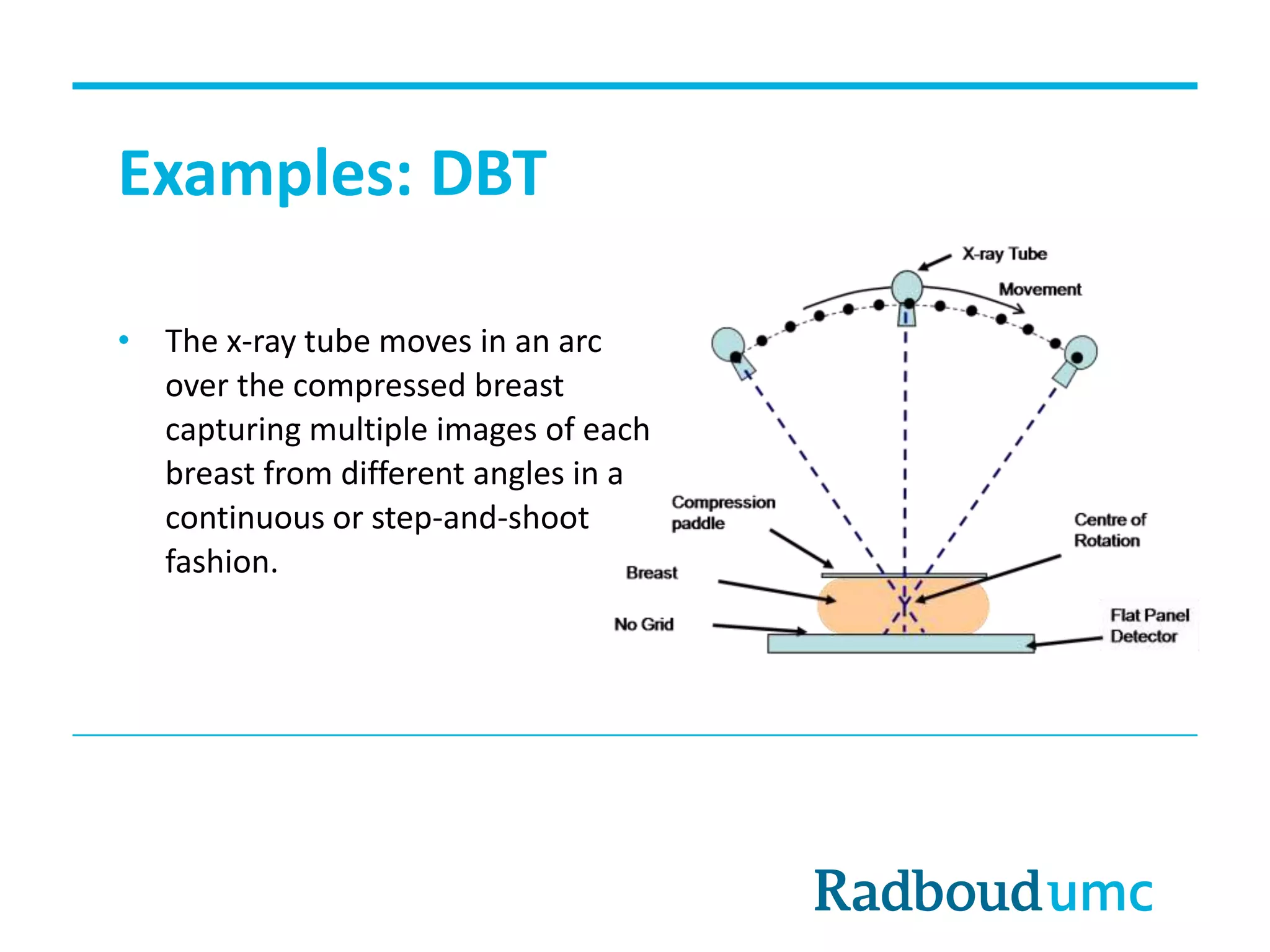 Inverse problems in medical imaging | PPTX