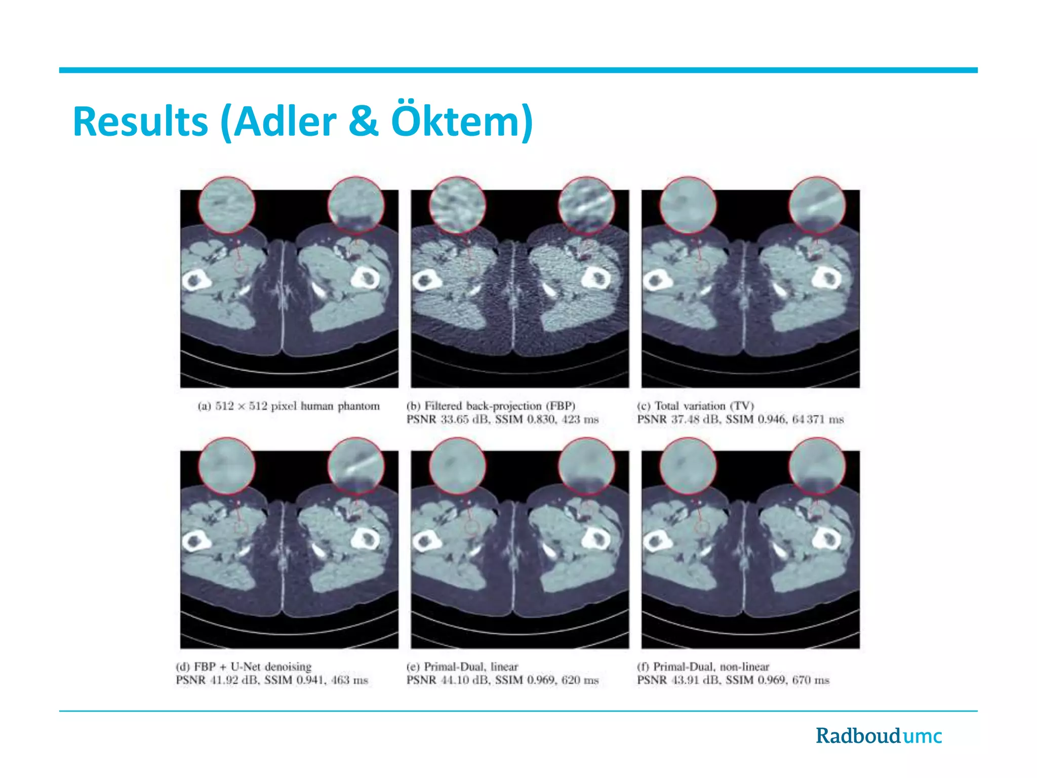 Inverse problems in medical imaging | PPTX