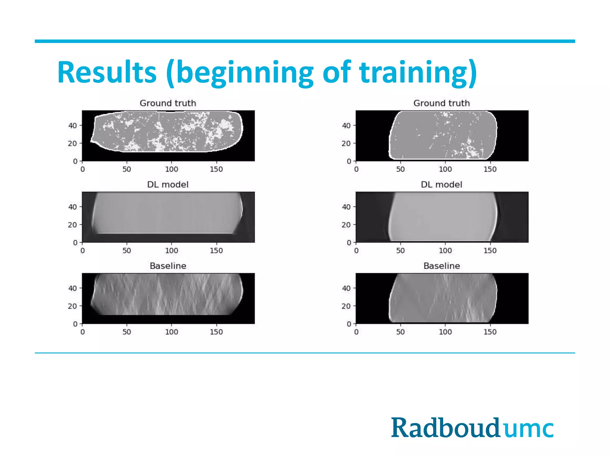 Inverse problems in medical imaging | PPTX