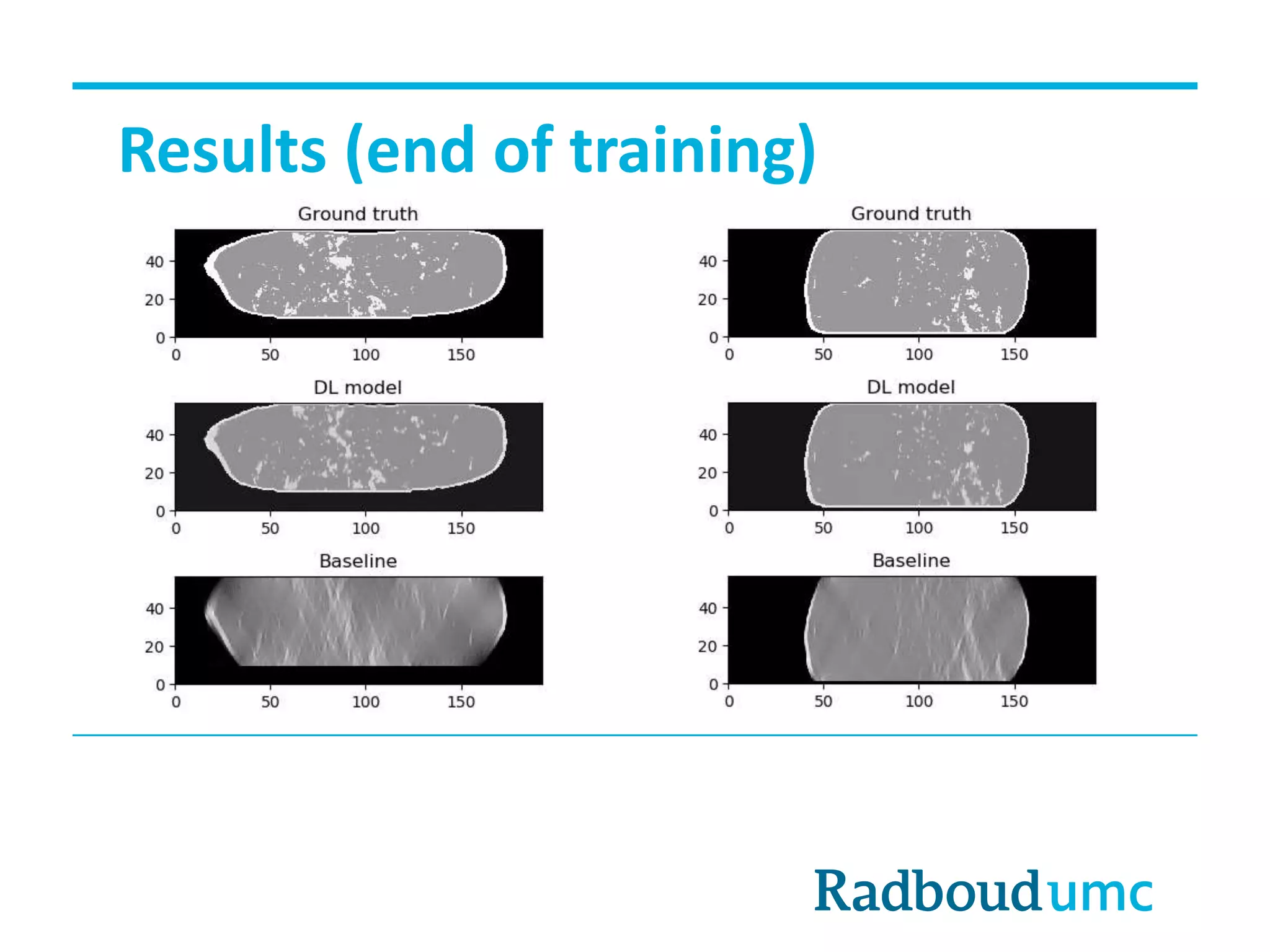 Inverse problems in medical imaging | PPTX