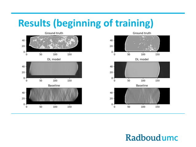 Inverse problems in medical imaging | PPTX