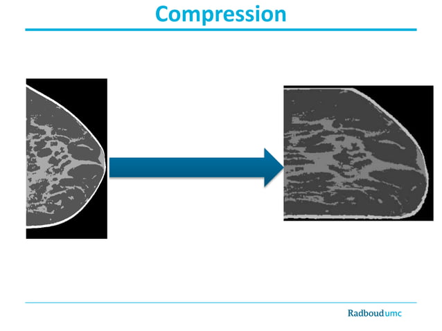 Inverse problems in medical imaging | PPTX
