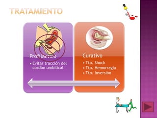 Inversión uterina | PPTX