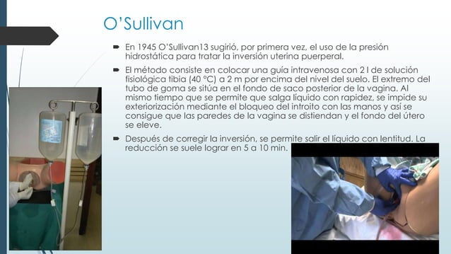 Inversión uterina | PPT