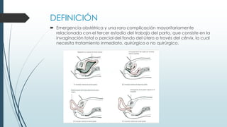 Inversión uterina | PPTX