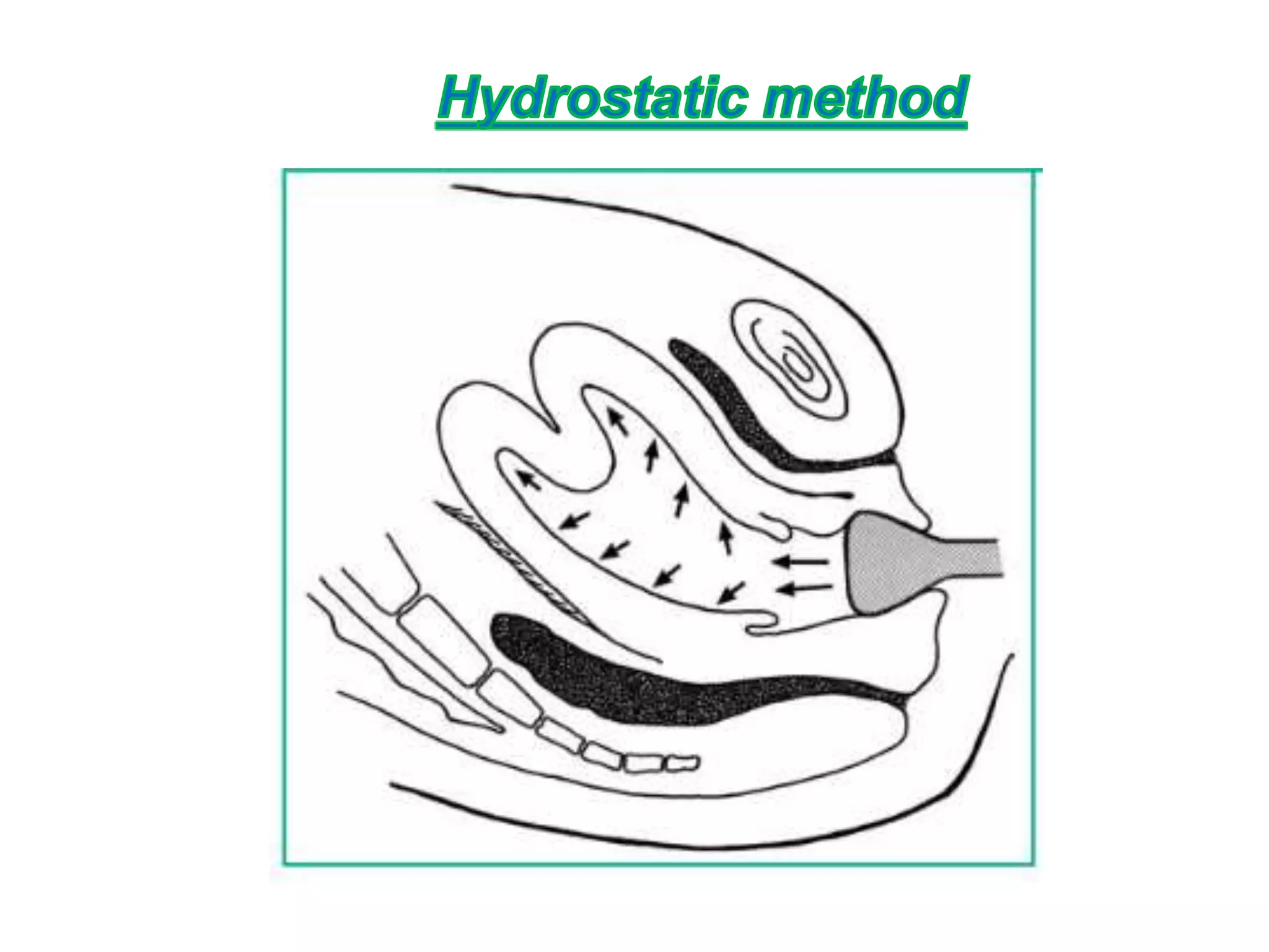 Inversion of the uterus | PPT
