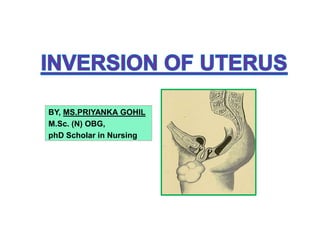 Inversion of the uterus | PPT