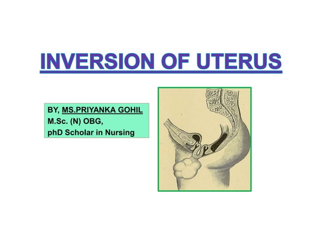 Inversion of the uterus | PPT | Pregnancy | Reproductive Health