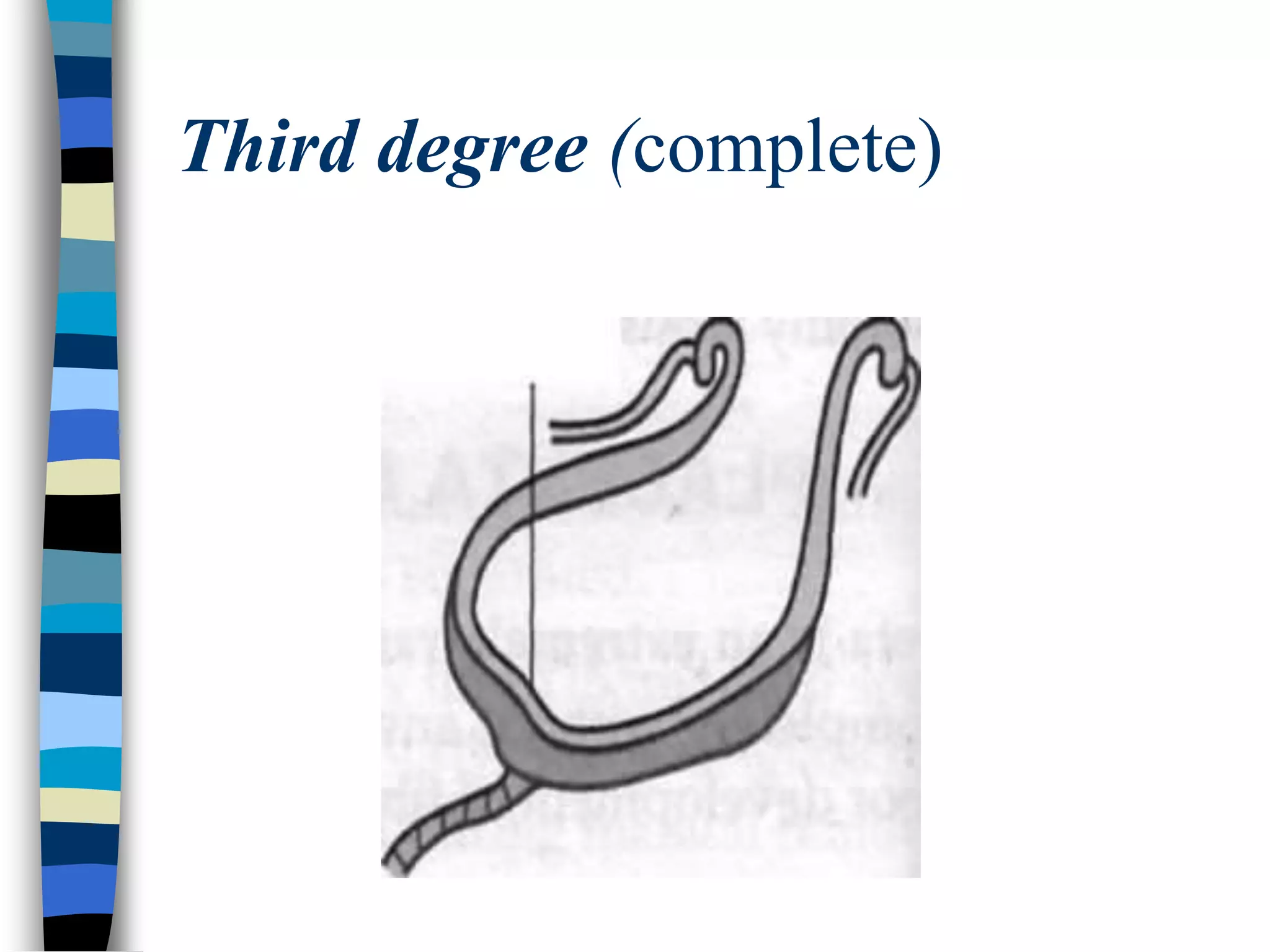 INVERSION OF THE UTERUS.pptx