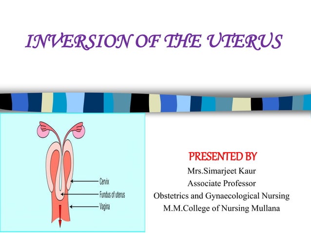 INVERSION OF THE UTERUS.pptx | Pregnancy | Reproductive Health