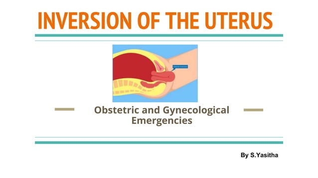 INVERSION OF THE UTERUS .pptx | Pregnancy | Reproductive Health