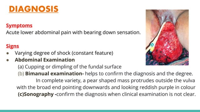 INVERSION OF THE UTERUS .pptx | Pregnancy | Reproductive Health