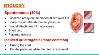 INVERSION OF THE UTERUS .pptx