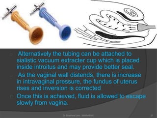 Inversion of uterus-170225210149-converted.pptx