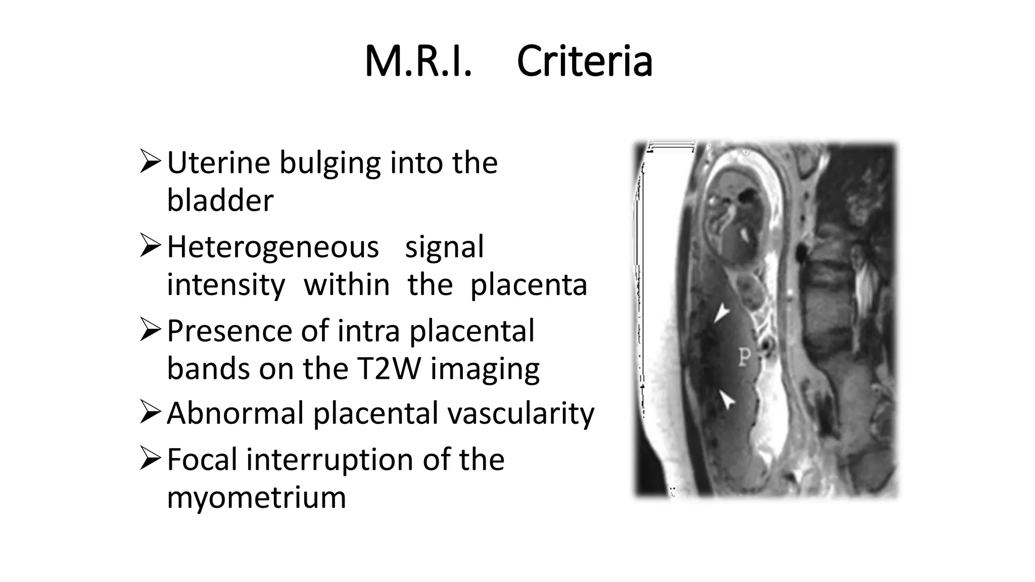 Inversion, retained placenta , afe | PPT