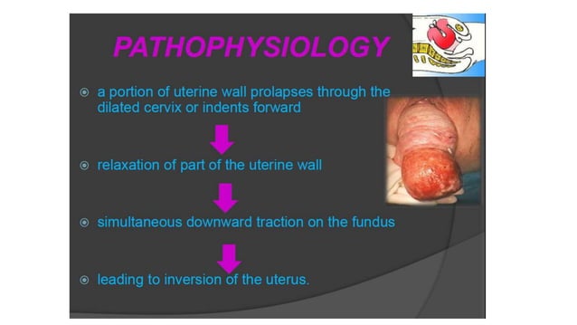 Inversion, retained placenta , afe | PPT