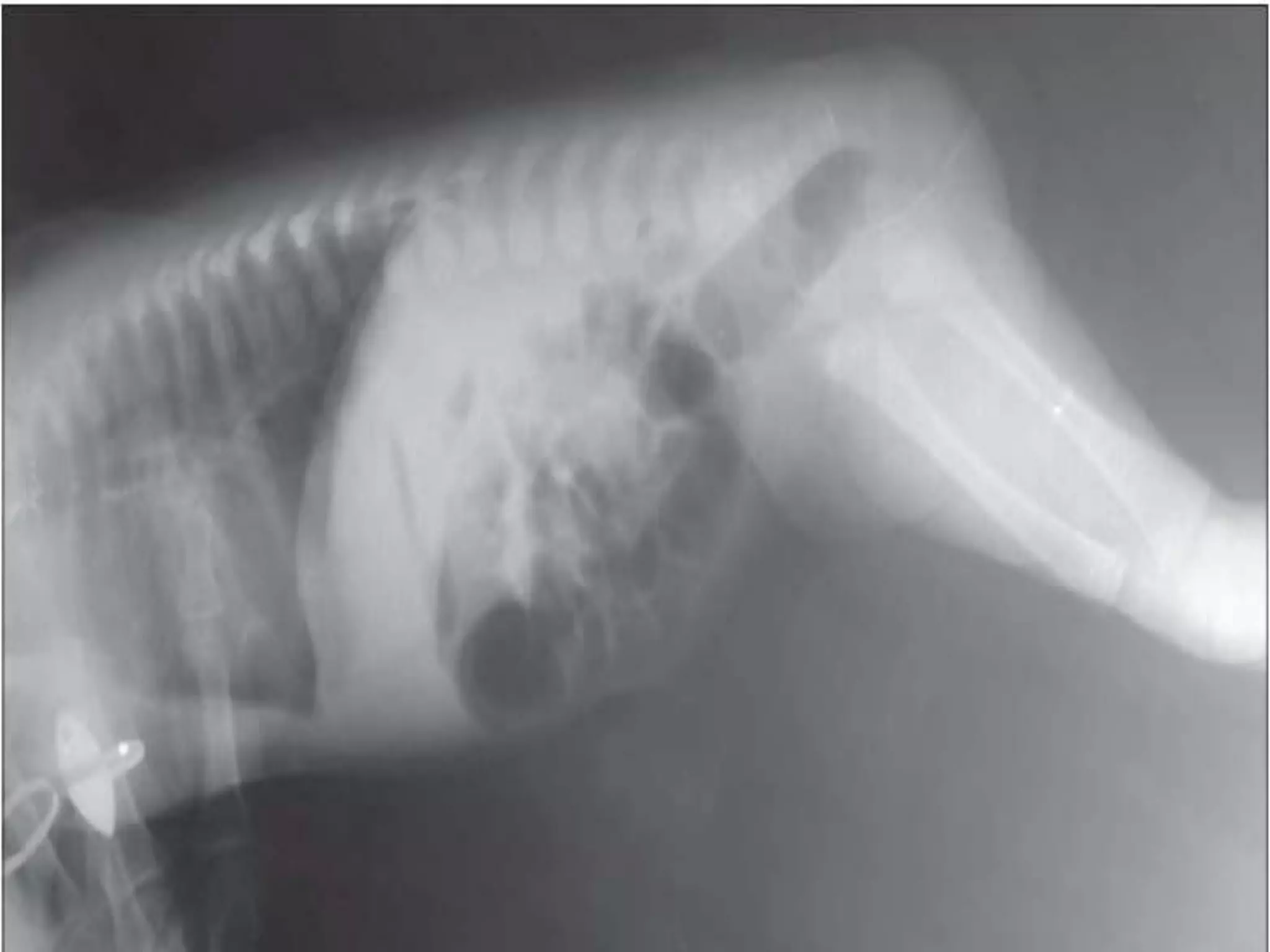 Invertogram ANORECTAL MALFORMATION ( ARM ) PRANAYA | PPTX | Pregnancy ...