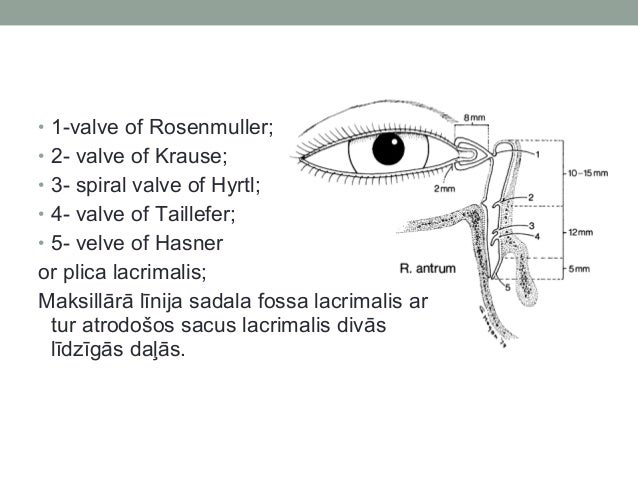 Invertētā papilloma