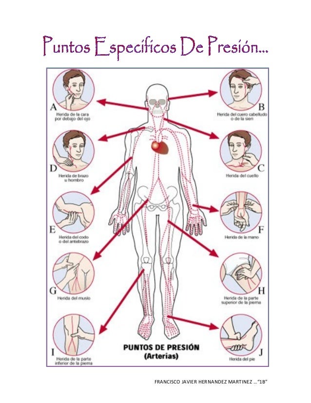 Investigación De Puntos Especificos De Presión Arterial