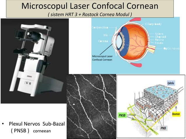 Investigatii avansate in retinopatia diabetica.pptx