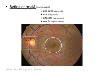 Investigatii avansate in retinopatia diabetica.pptx