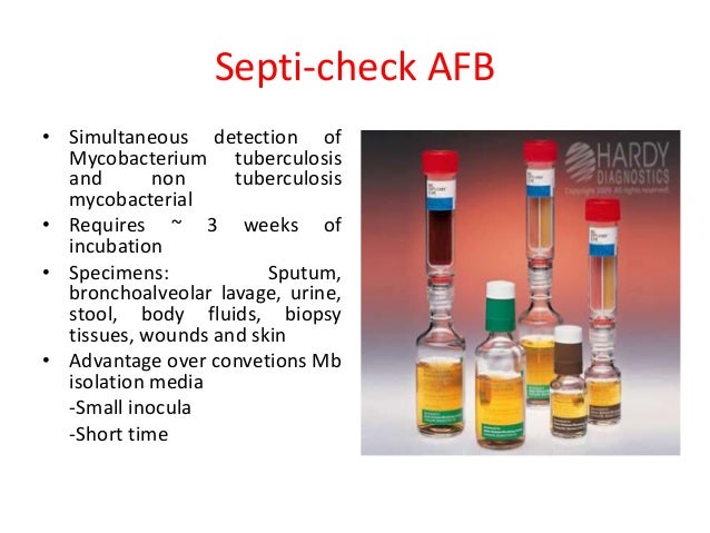 Investigations in Tuberculosis and advances