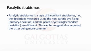 Investigation in paralytic strabismus | PPT