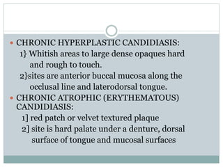 Investigation of Candidiasis.pptx