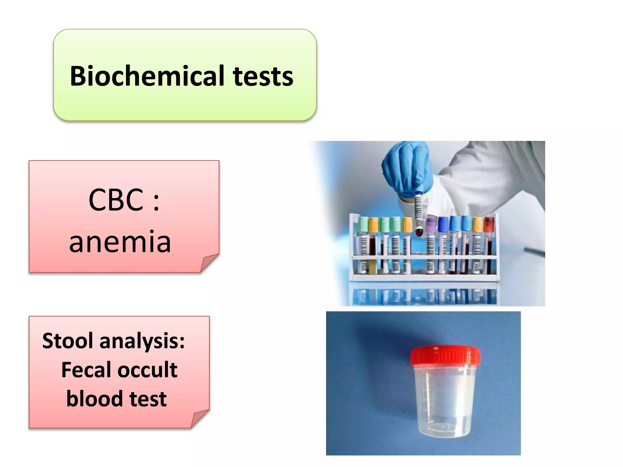 Investigation of lower git bleeding final | PPTX