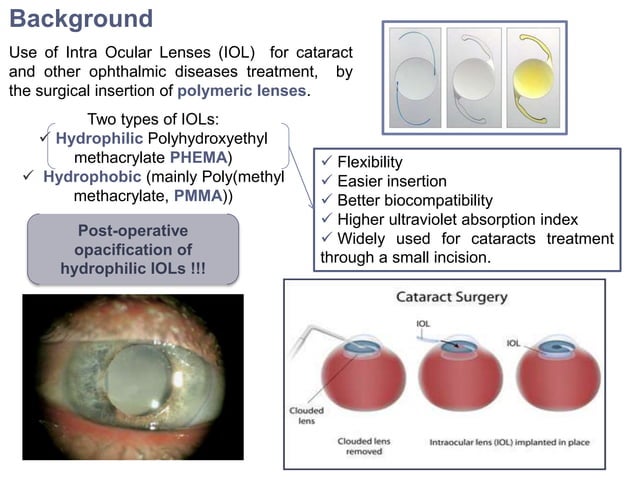 Investigation of opacification mechanism of hydrophilic intraocular ...