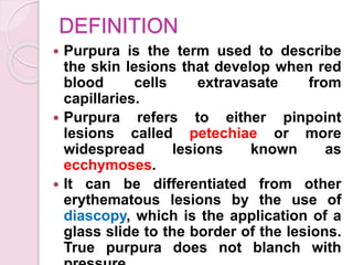 Investigation of purpuric rash | PPTX