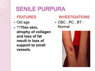 Senile Purpura Face