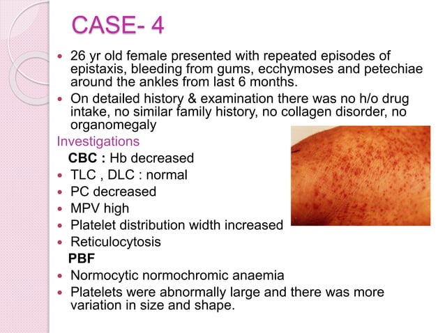 Investigation of purpuric rash | PPT