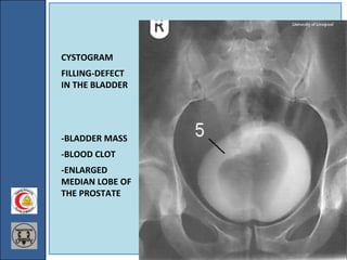 Investigations of Urology | PPT