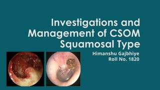 Investigations and Management of CSOM Squamosal Type.pptx