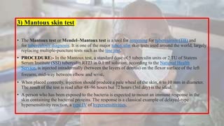 INVESTIGATIONS AND TREATMENT OF TUBERCULOSIS.pptx