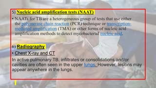 INVESTIGATIONS AND TREATMENT OF TUBERCULOSIS.pptx