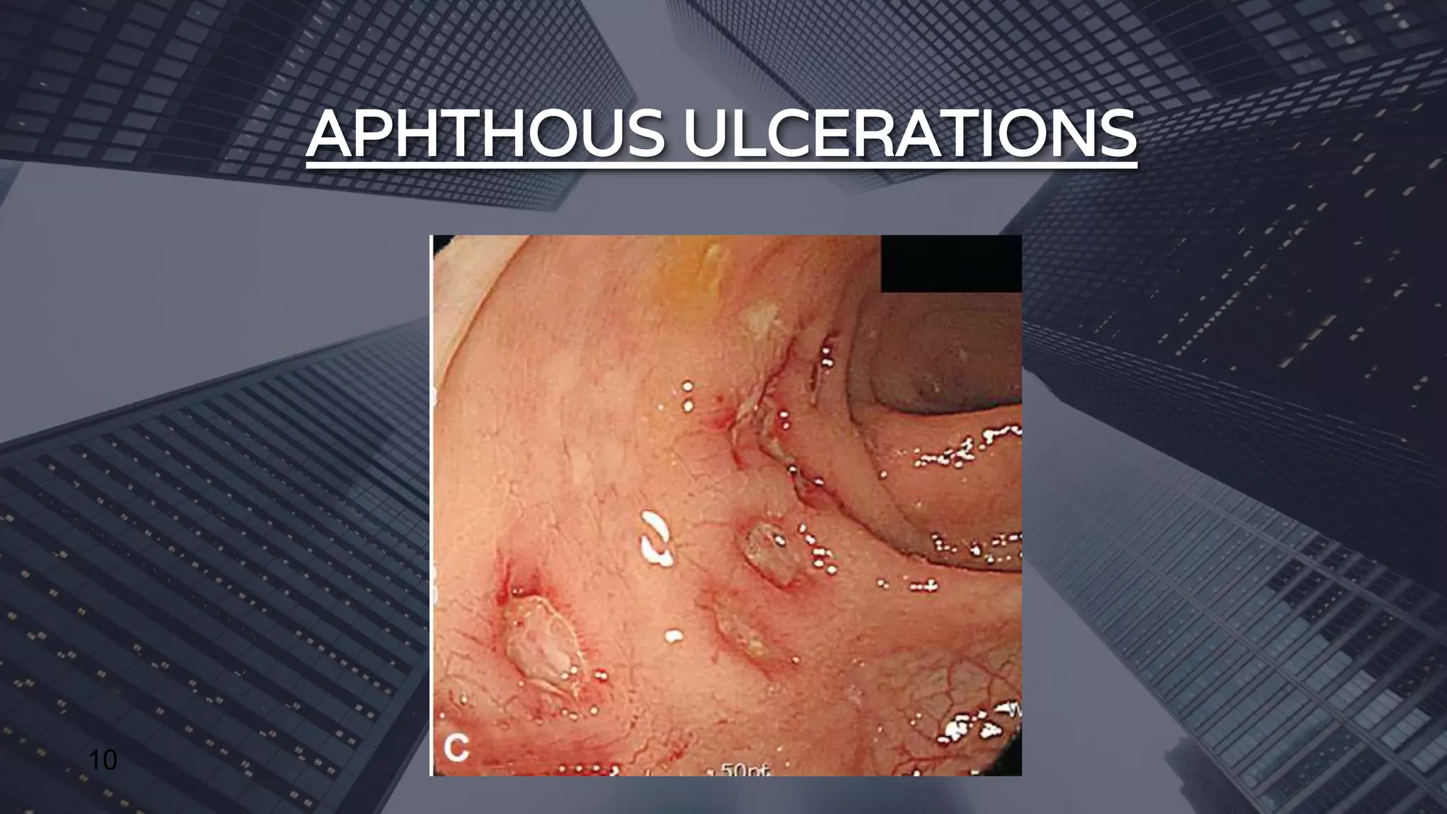Investigations CROHNS Disease.pptx