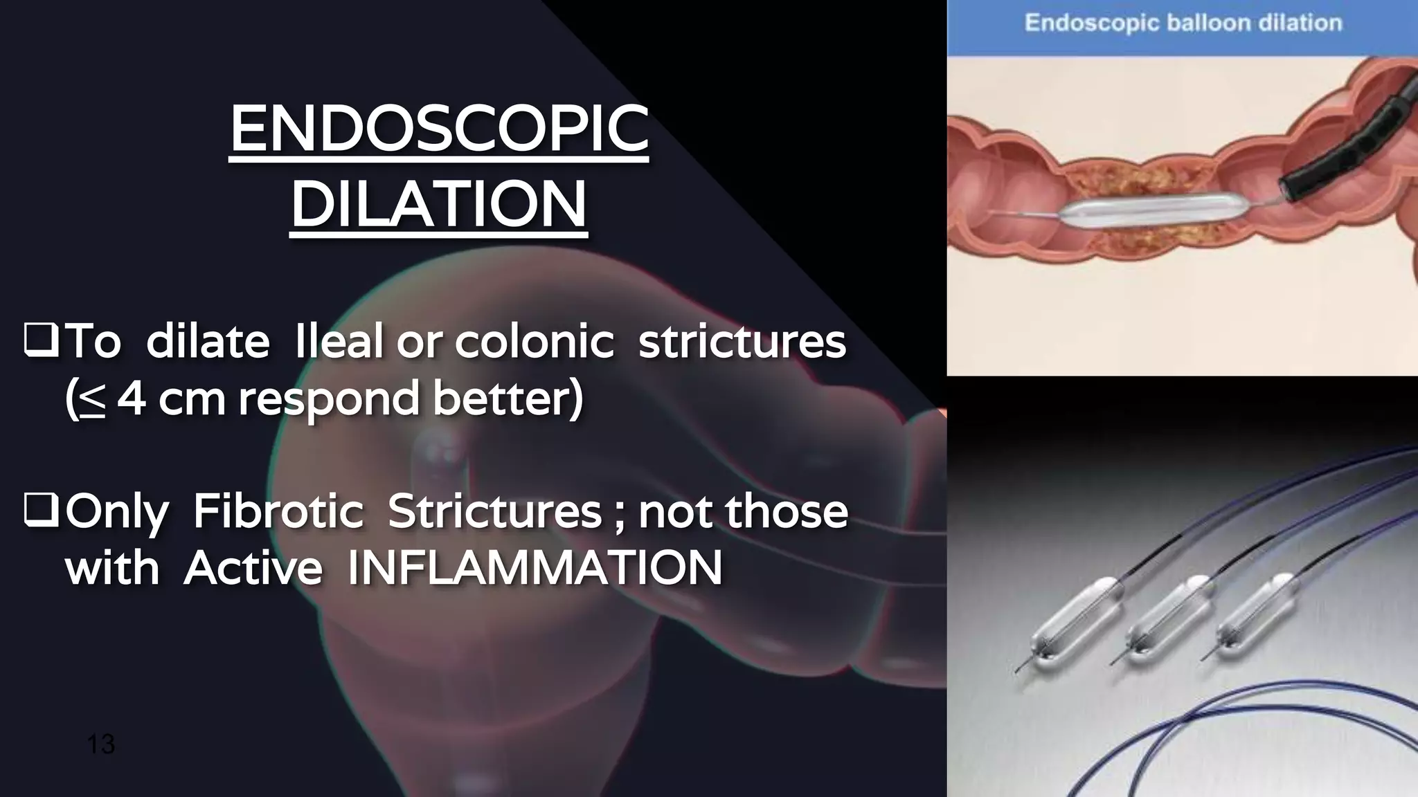 Investigations CROHNS Disease.pptx