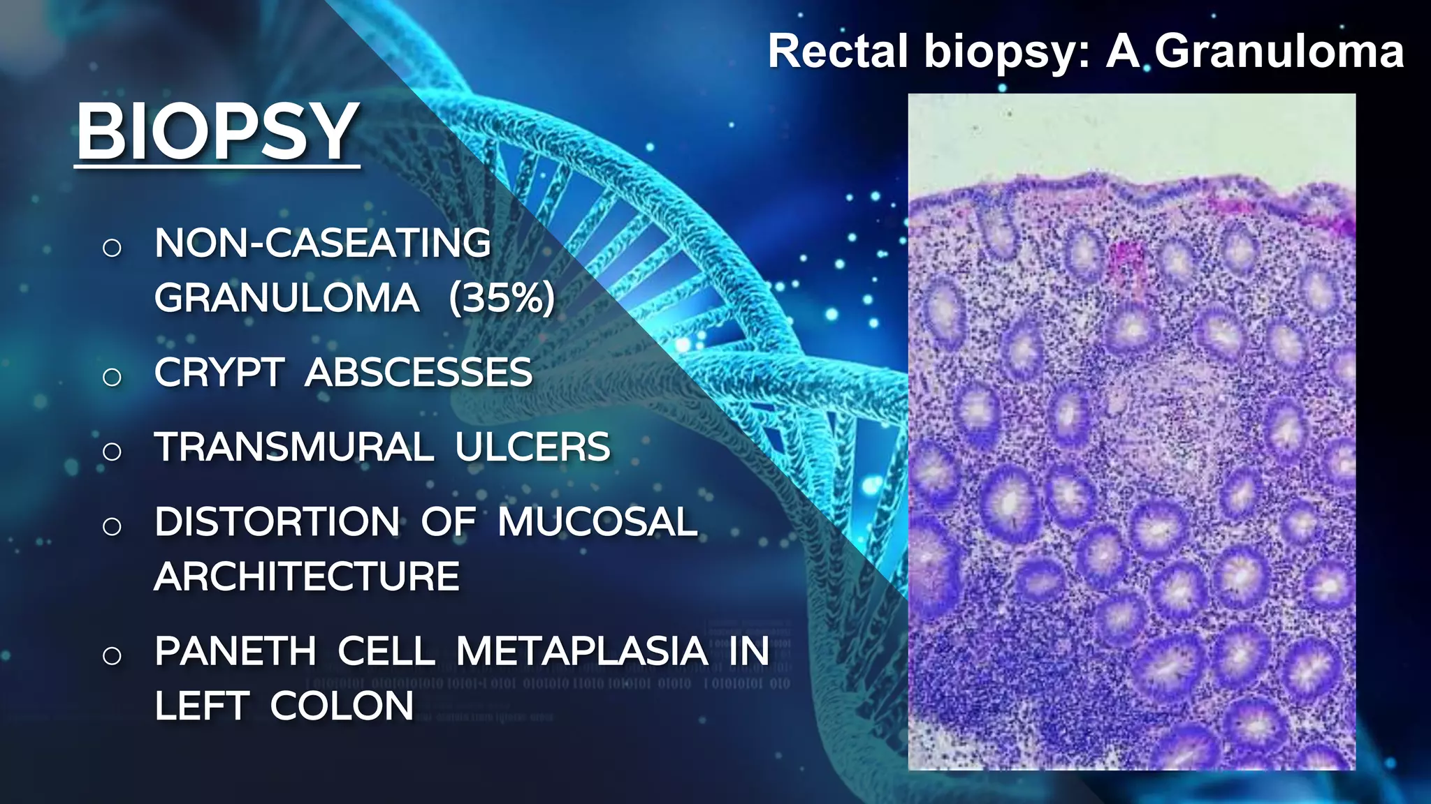 Investigations CROHNS Disease.pptx