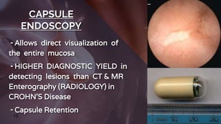 Investigations CROHNS Disease.pptx